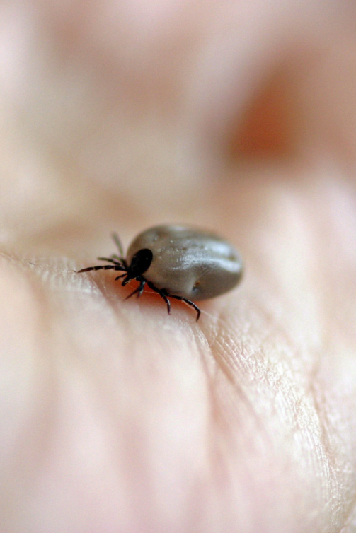 Living with Lyme Disease